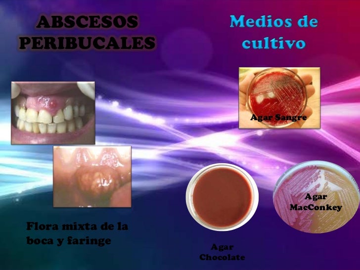 Secreciones purulentas-formas de diagnostico
