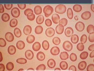 Micro cytic hypochromic ... | PPTX