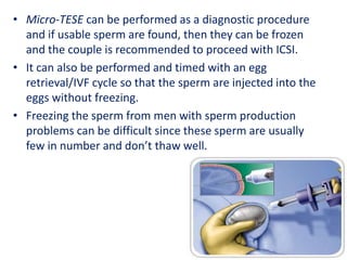 Micro tese Specialist | PPTX | Infertility | Reproductive Health