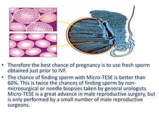 Micro tese Specialist | PPTX | Infertility | Reproductive Health