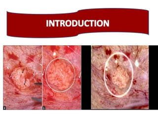 Micro tese Specialist | PPT