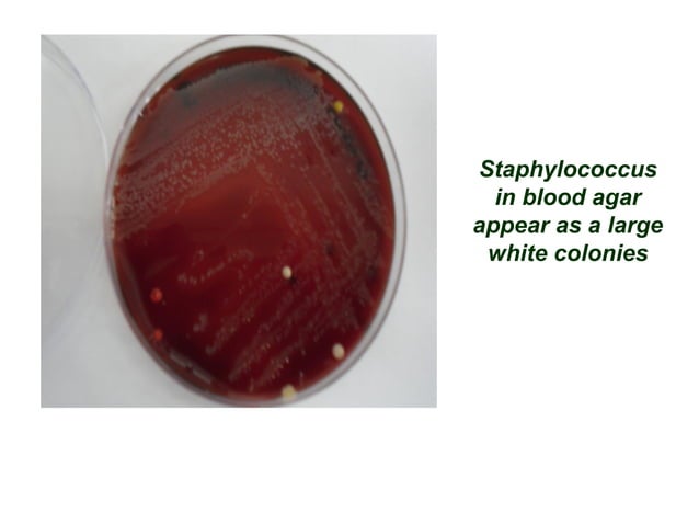 Staphylococcus & streptococcus | PPT | Blood Disorders | Diseases and Conditions