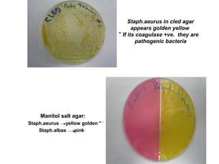 Staphylococcus & streptococcus | PPT
