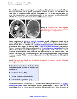 Radiological pathology of cerebral microbleeds | PDF
