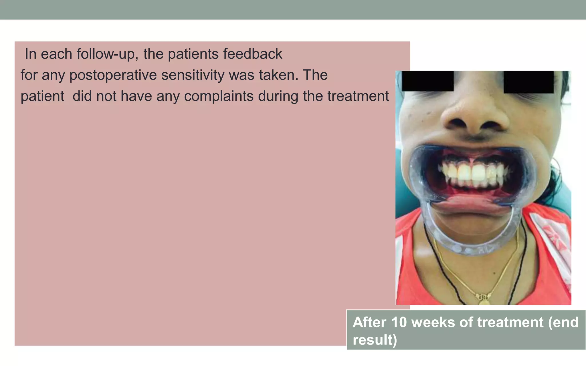 Microabrasion remineralization | PPTX