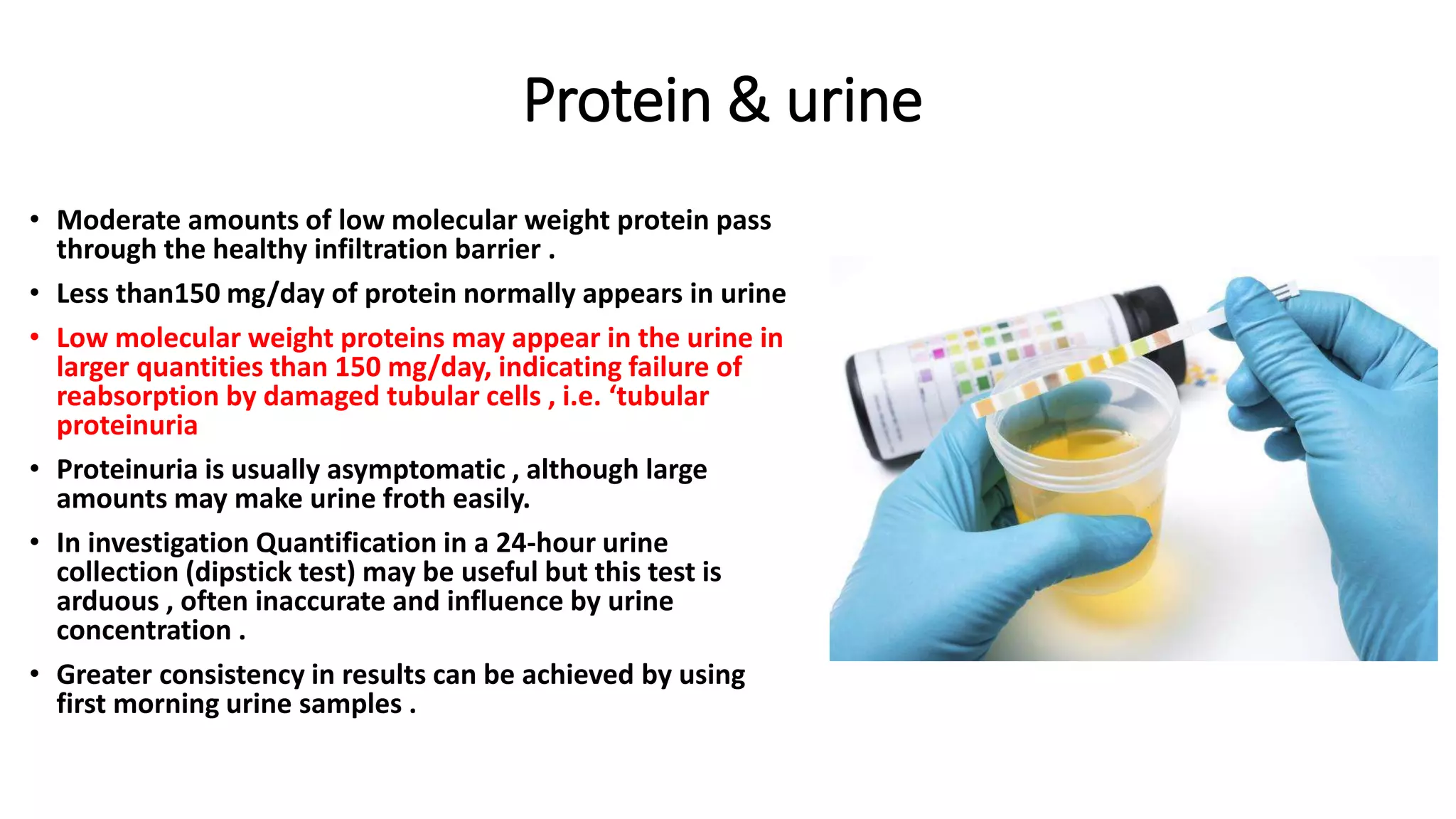 Microalbuminuria in simple way | PPTX