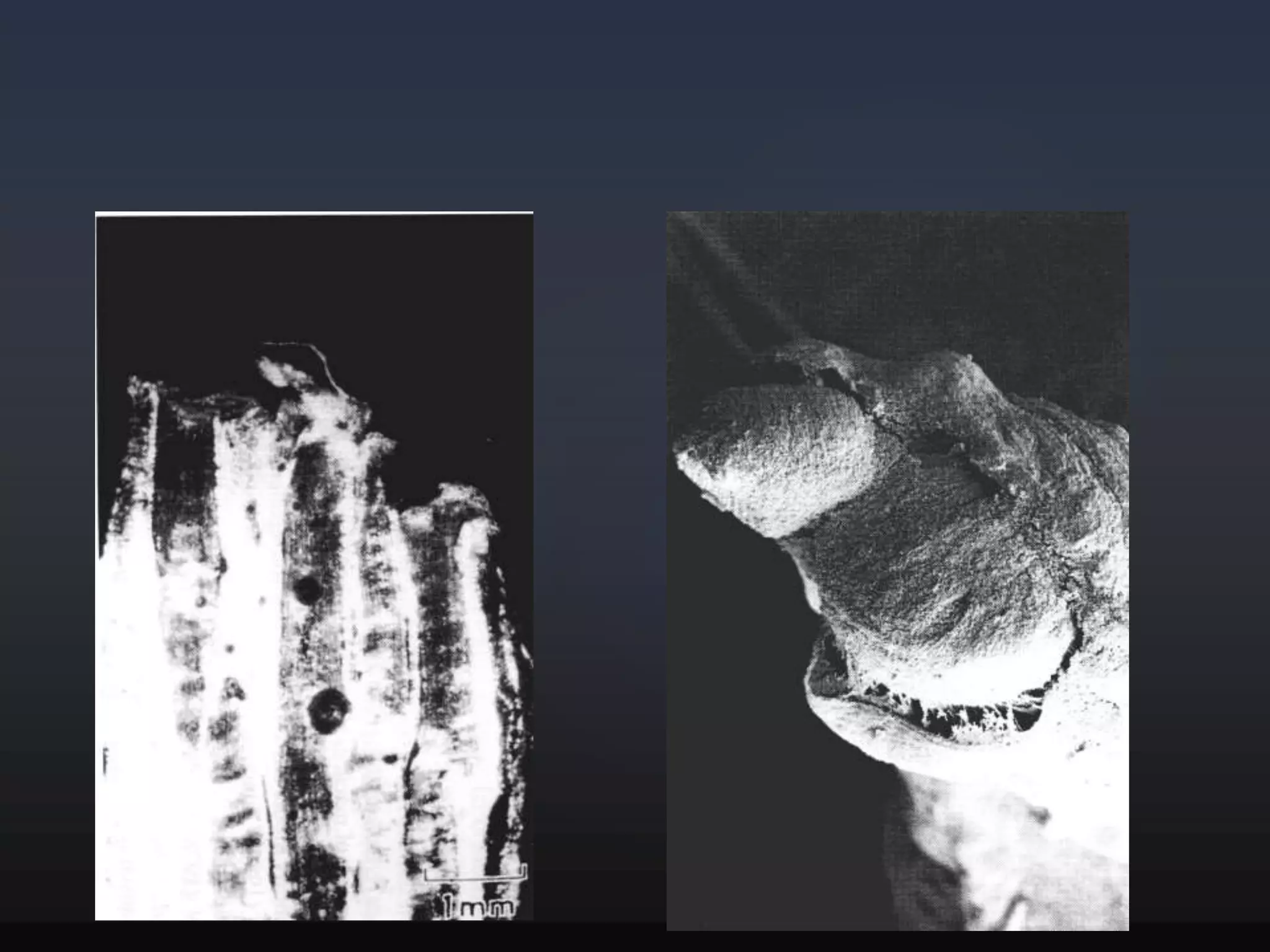 Microanatomy of the nerve | PPTX