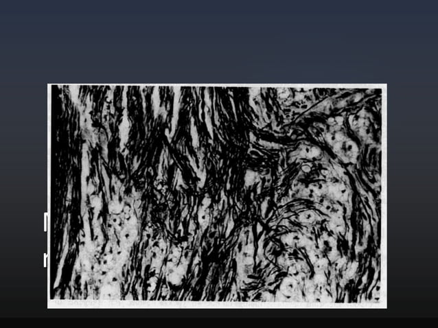 Microanatomy of the nerve | PPTX | Biological Sciences | Science