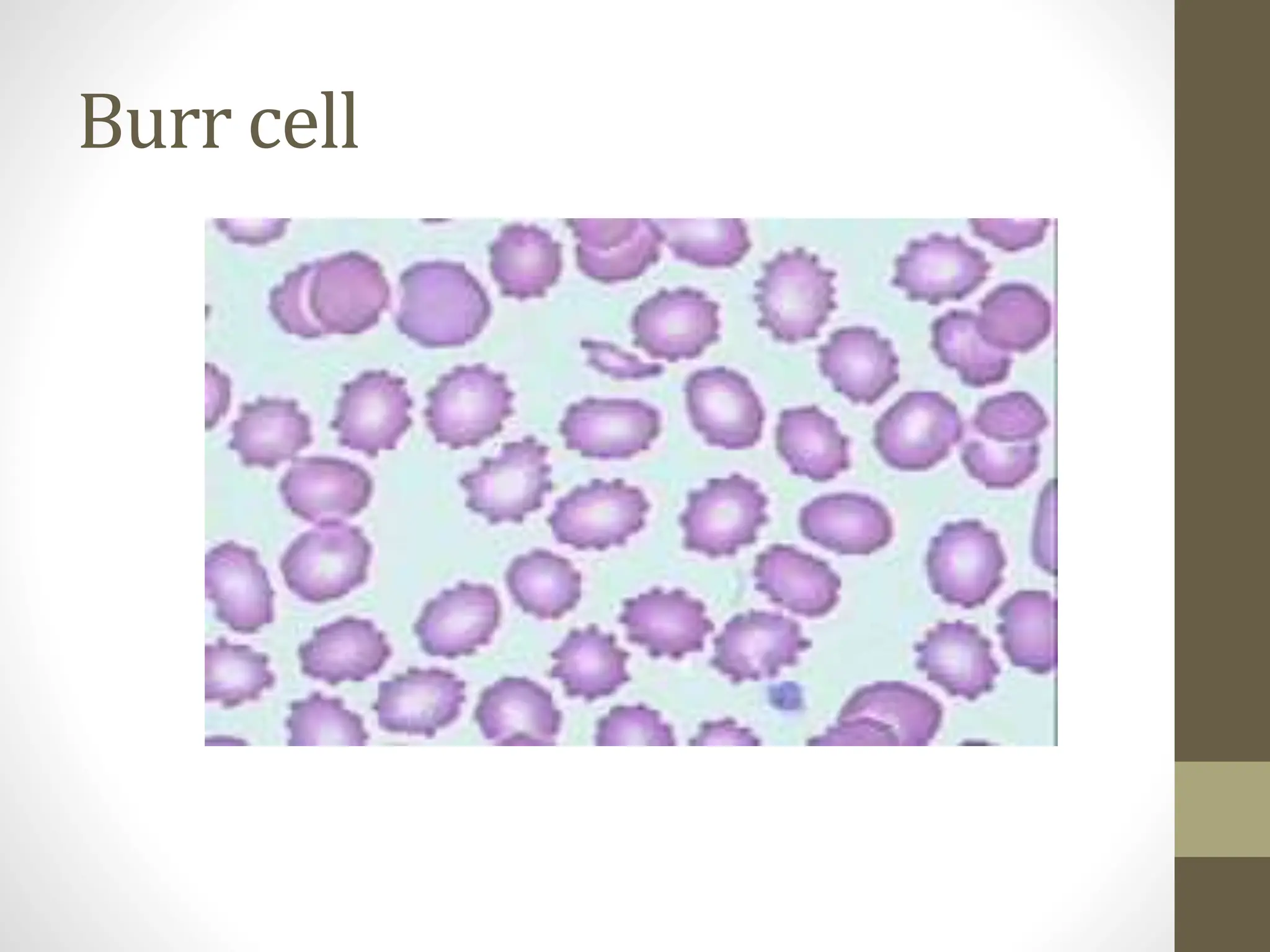 MICROANGIOPATHIC HEMOLYTIC ANEMIA - MAHA.pptx