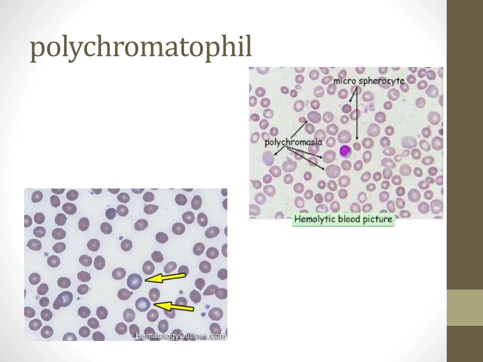 MICROANGIOPATHIC HEMOLYTIC ANEMIA - MAHA.pptx
