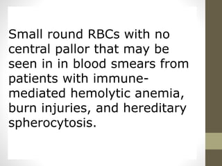 MICROANGIOPATHIC HEMOLYTIC ANEMIA - MAHA.pptx