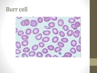 MICROANGIOPATHIC HEMOLYTIC ANEMIA - MAHA.pptx