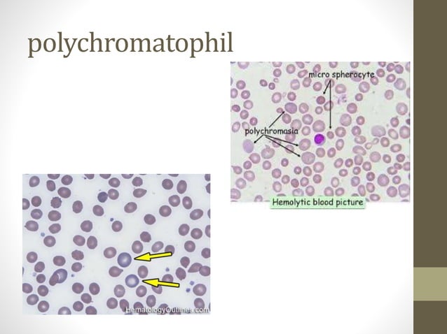 MICROANGIOPATHIC HEMOLYTIC ANEMIA - MAHA.pptx