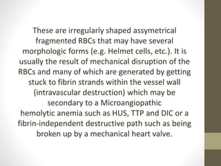 MICROANGIOPATHIC HEMOLYTIC ANEMIA - MAHA.pptx
