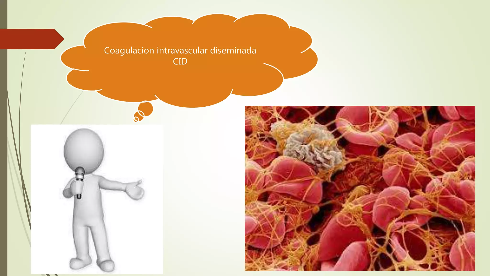 Microangiopatia Trombotica y Sindrome de Coagulacion Intravascular ...