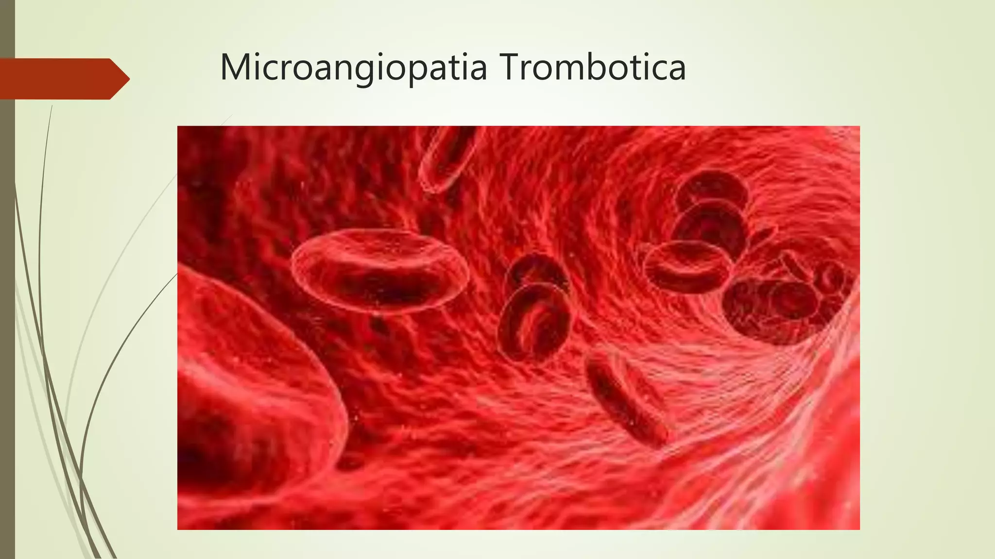 Microangiopatia Trombotica y Sindrome de Coagulacion Intravascular ...