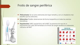 Microangiopatia Trombotica y Sindrome de Coagulacion Intravascular ...