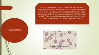 Microangiopatia Trombotica y Sindrome de Coagulacion Intravascular ...