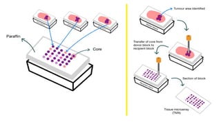 MICROARRAYS - Bioinformatics and Genetic Engineering | PPTX ...