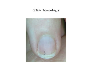 Microbes affecting the Cardiovas Syst.pptx