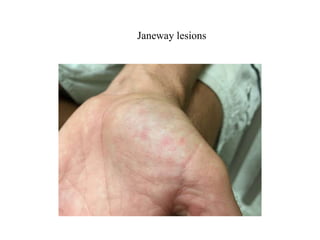 Microbes affecting the Cardiovas Syst.pptx