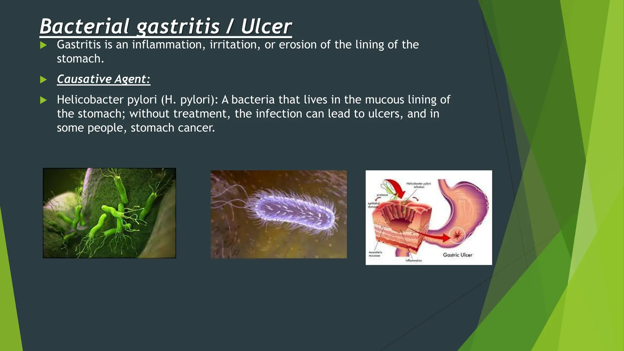 Microbial-infection-Digestive-System.pptx