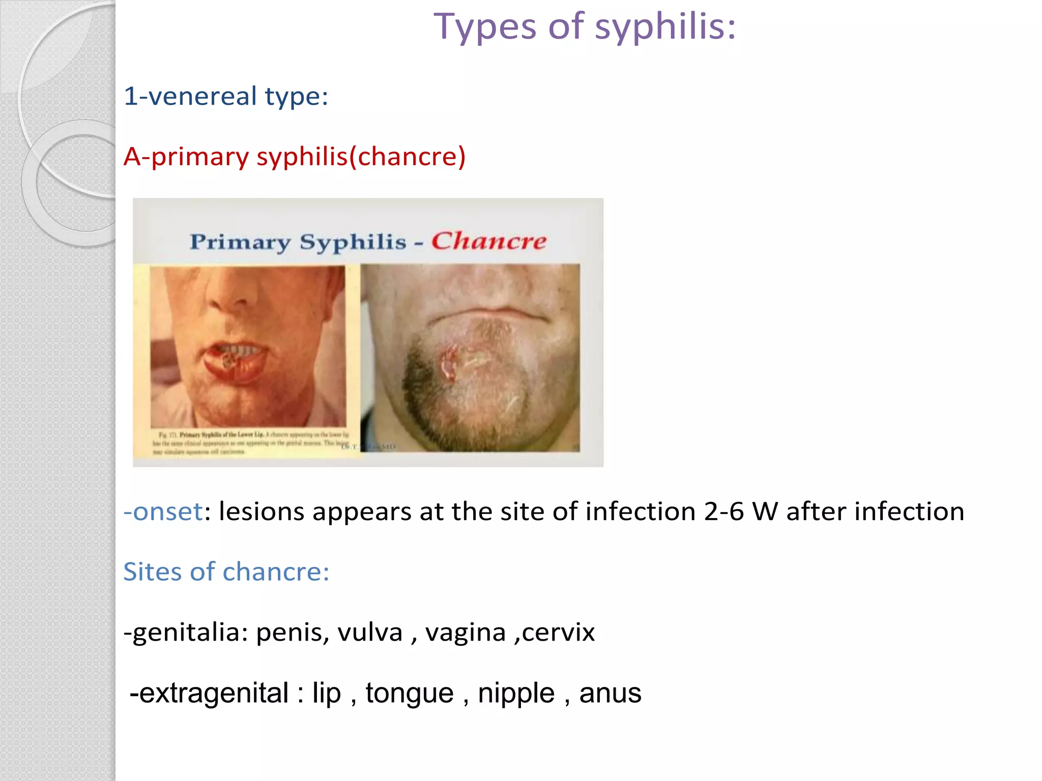 Microbial infections-related-to-oral-cavity | PPTX