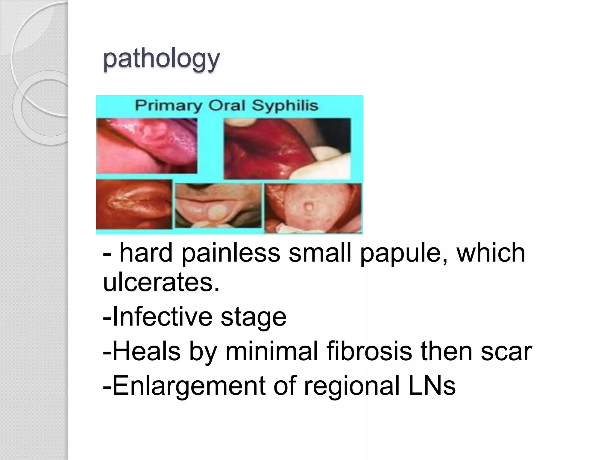 Microbial infections-related-to-oral-cavity | PPTX
