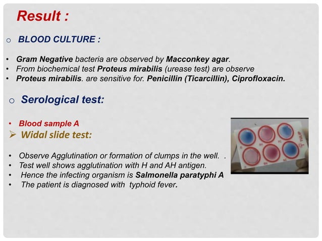 microbial analysis.pptx