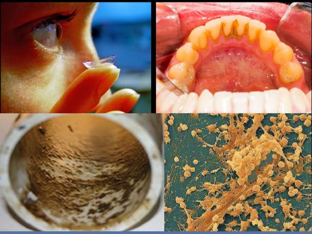 Microbial biofilms formation | PPT