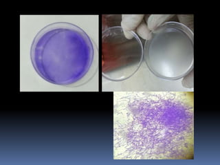 Microbial biofilms formation | PPTX