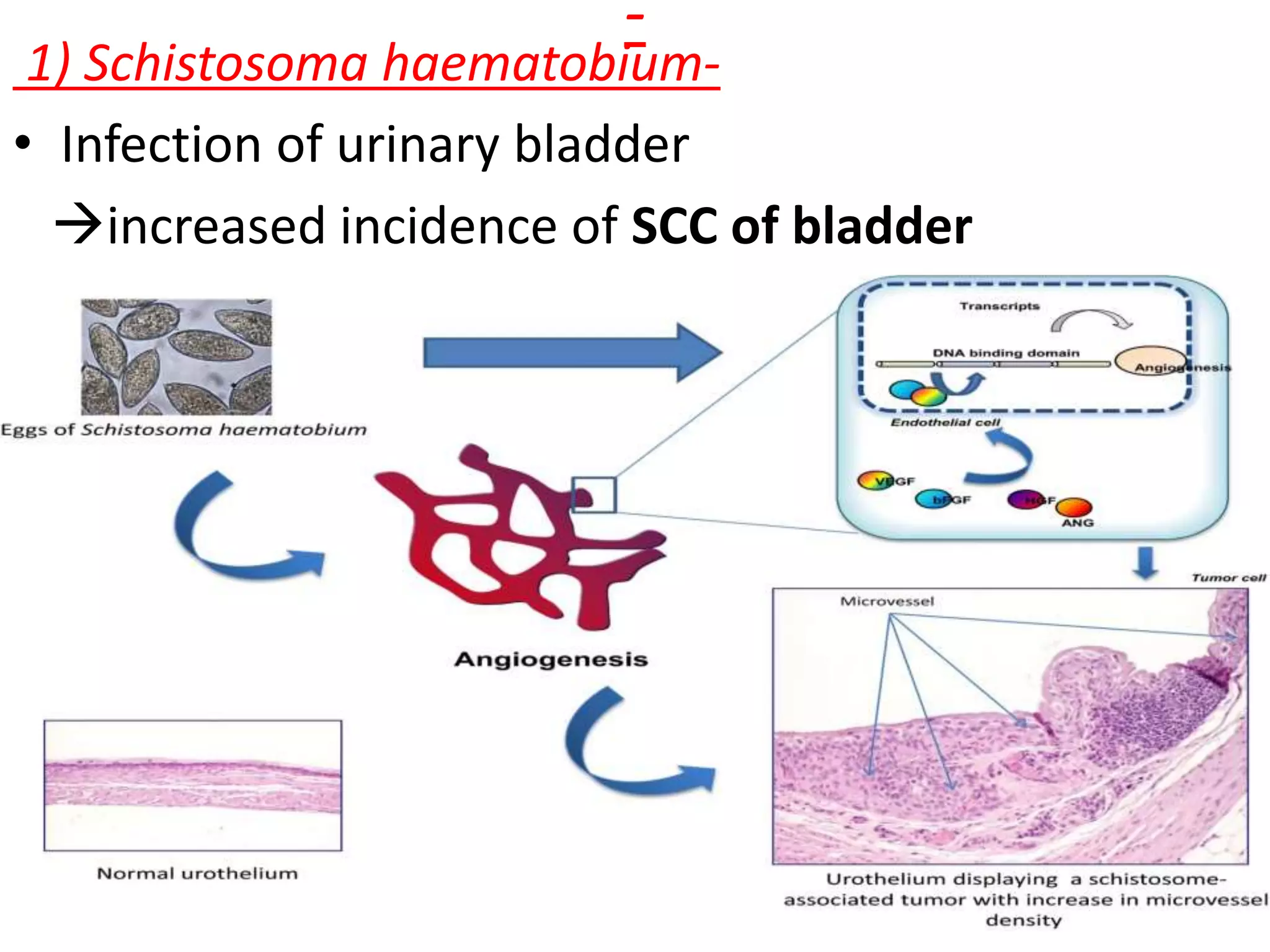 Microbial carcinogenesis - Molecular Mechanism of Cancer | PPTX