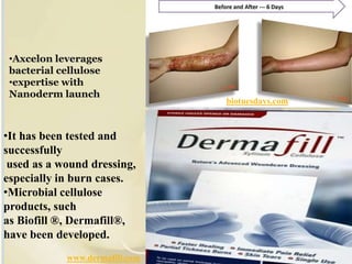 Microbial cellulose | PPTX