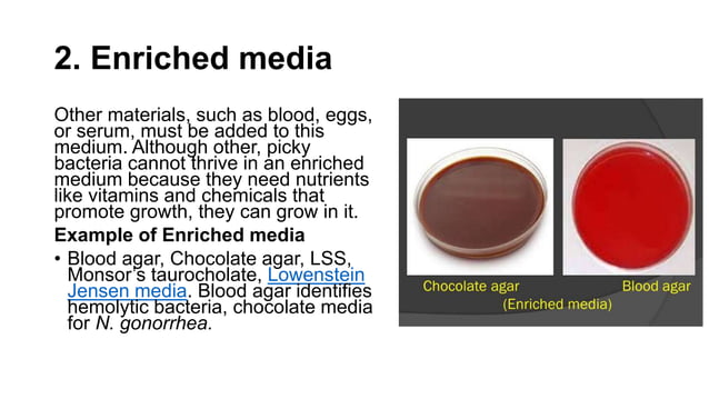Microbial Culture Media types and examples.pptx