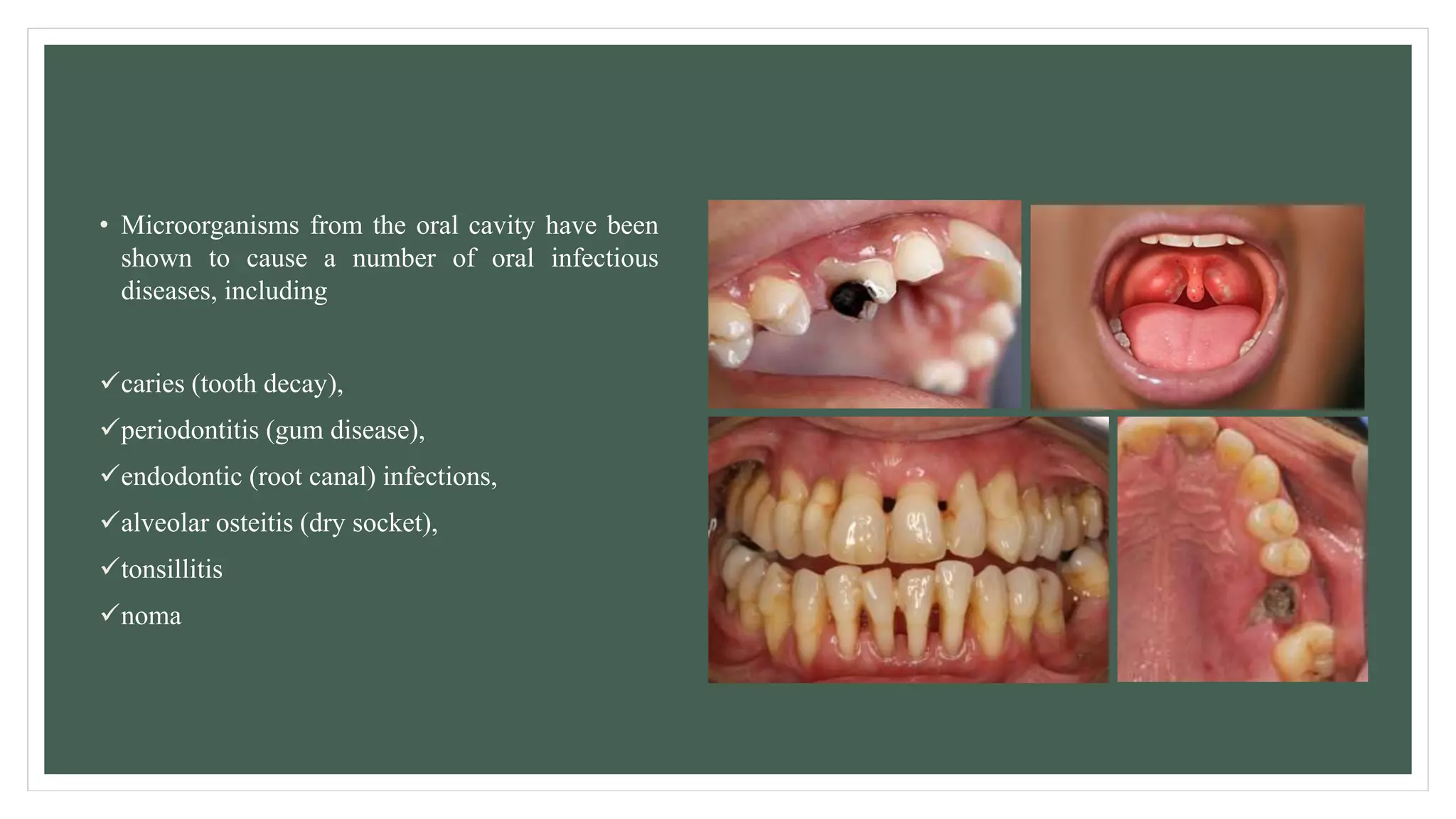 Microbial flora of oral cavity | PPTX