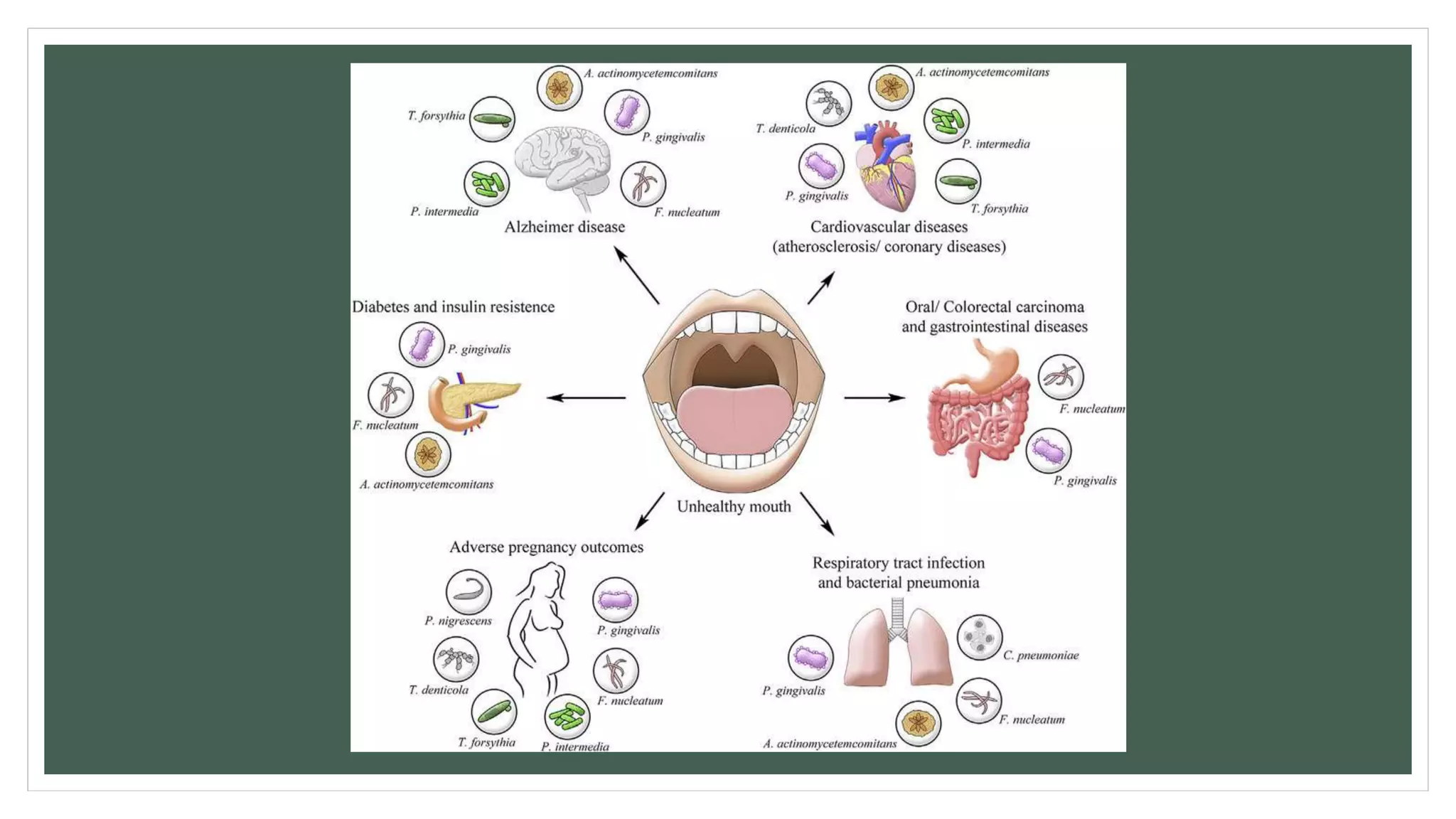 Microbial flora of oral cavity | PPTX
