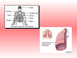 Microbial Human Diseases | PPT