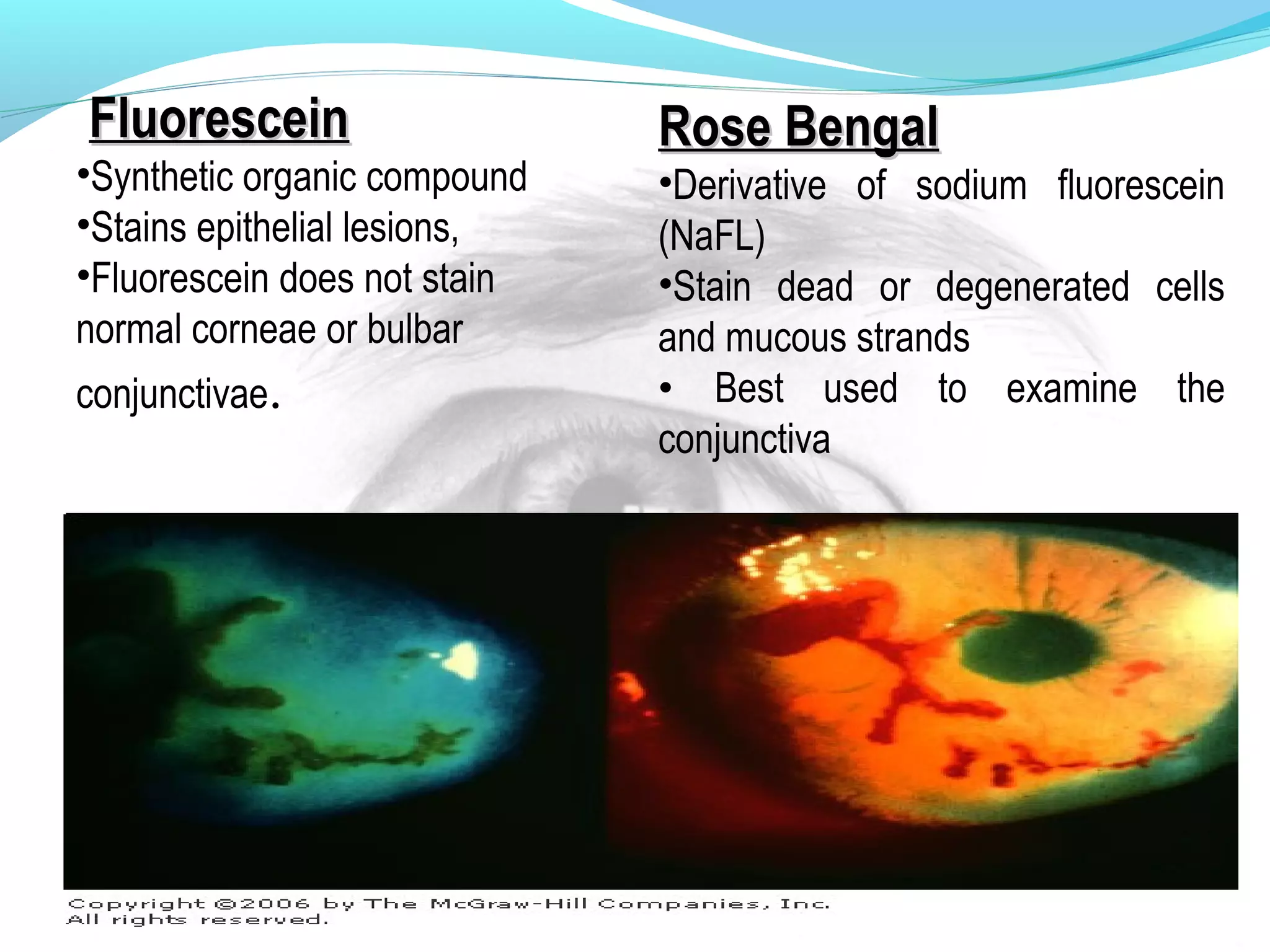 Microbial keratitis | PPT