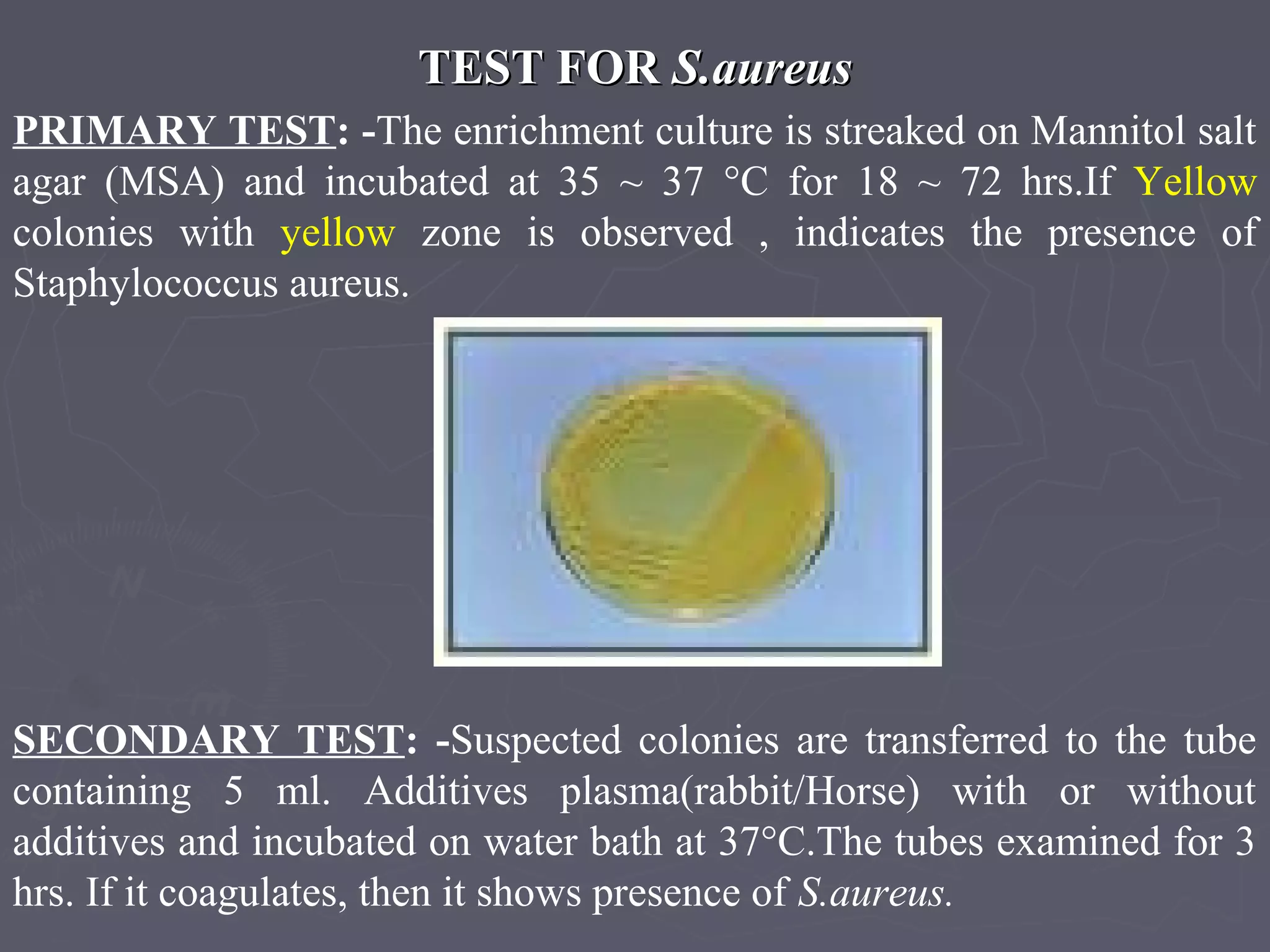 Microbial limit test | PPT