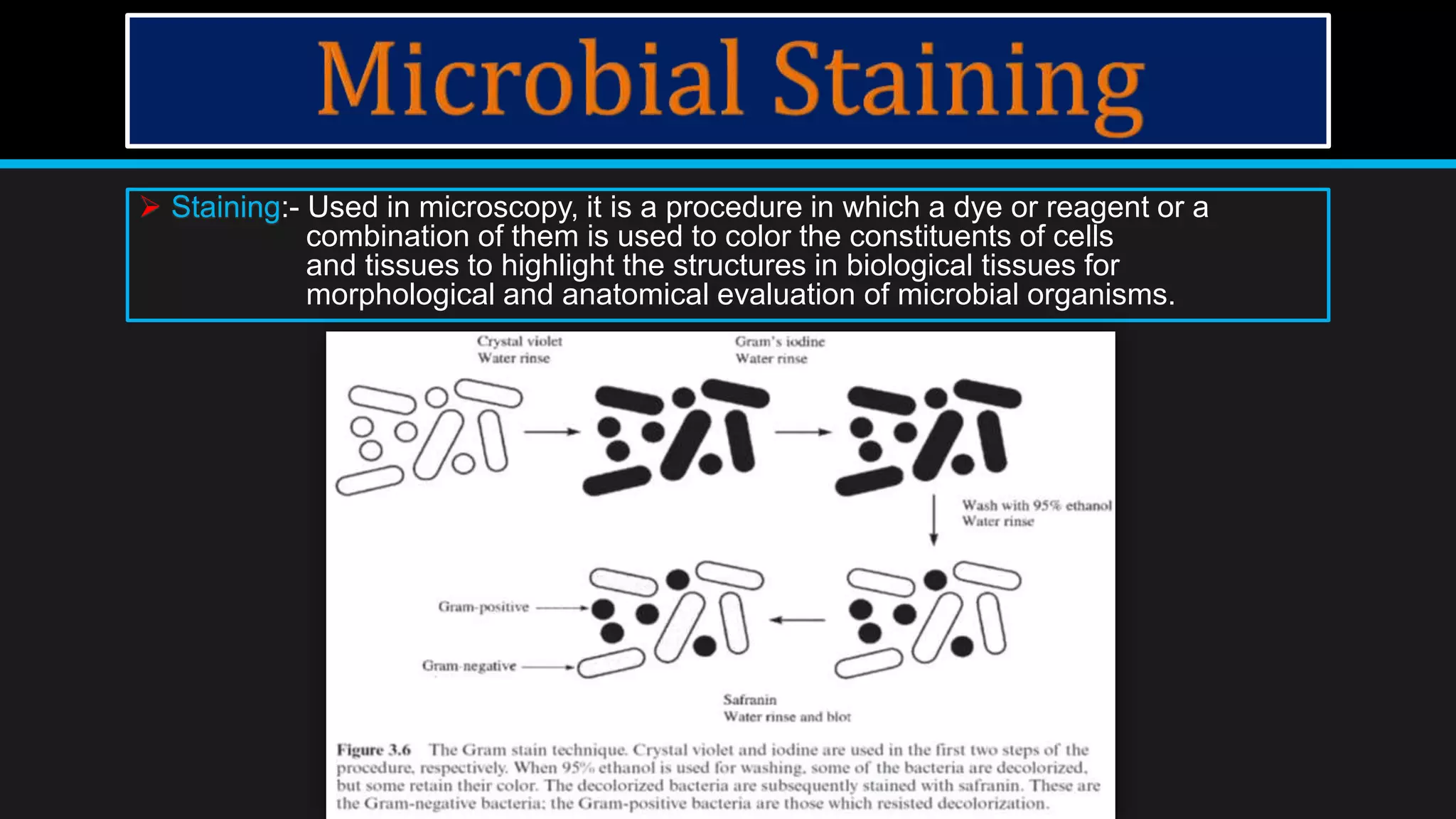 Bacterial Staining, Staining and it's types, Illustratec with detailed ...