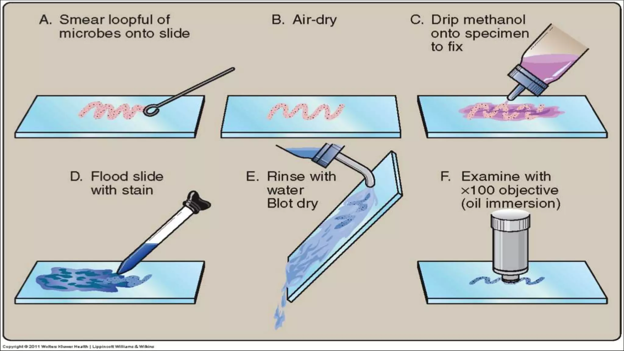 Bacterial Staining, Staining and it's types, Illustratec with detailed ...