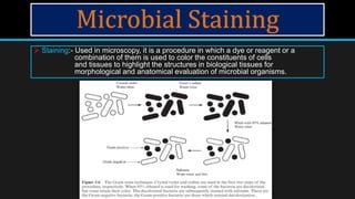 Bacterial Staining, Staining and it's types, Illustratec with detailed ...