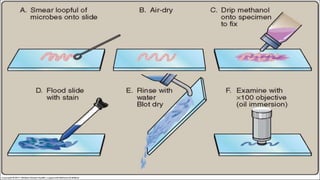 Bacterial Staining, Staining and it's types, Illustratec with detailed ...