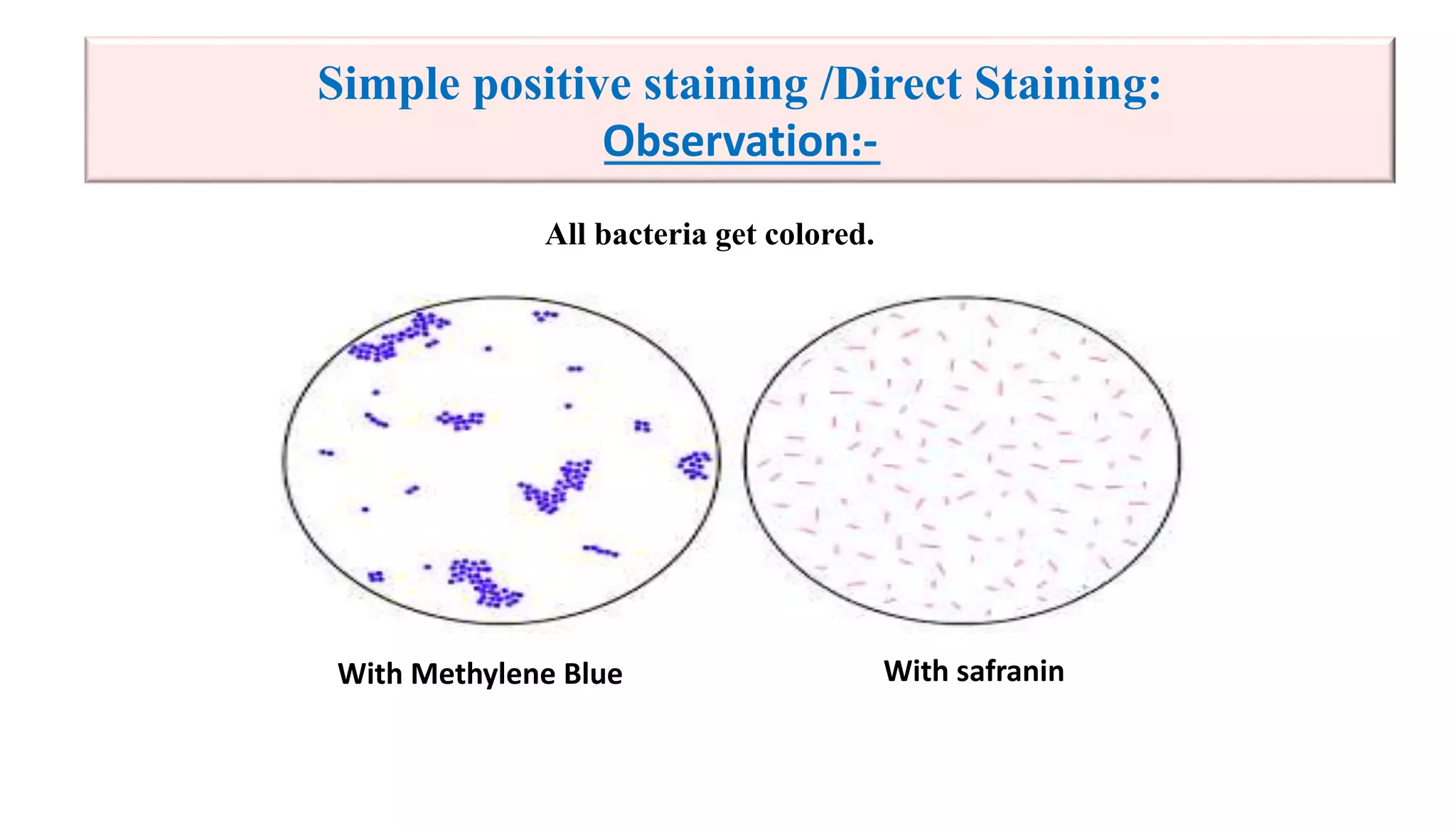 Microbial staining | PPT