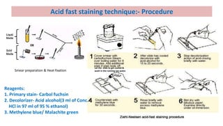 Microbial staining | PPT