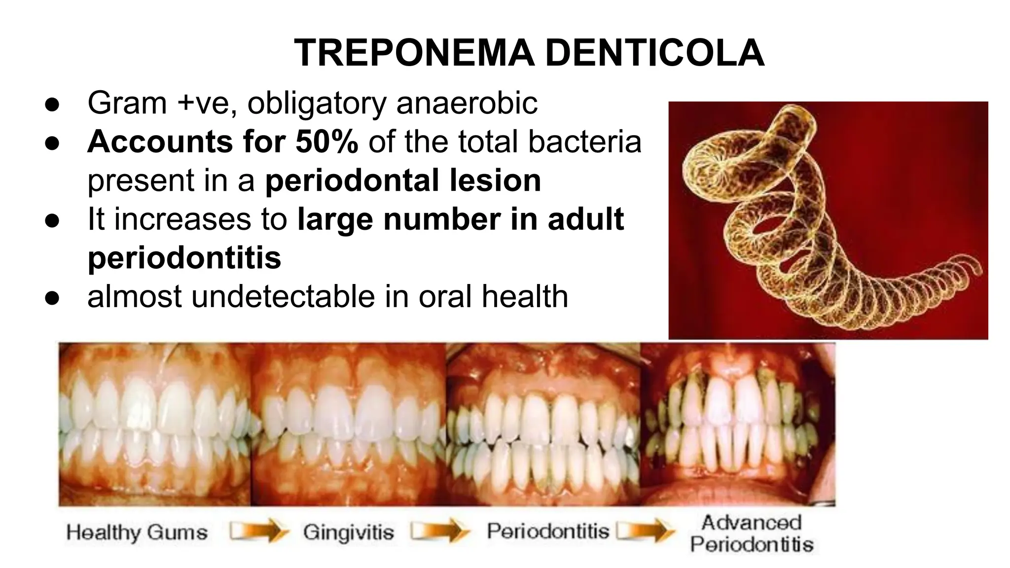 Bacterial Spectrum in Relation to Periodontal Diseases | PDF
