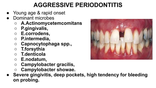 Bacterial Spectrum in Relation to Periodontal Diseases | PPT