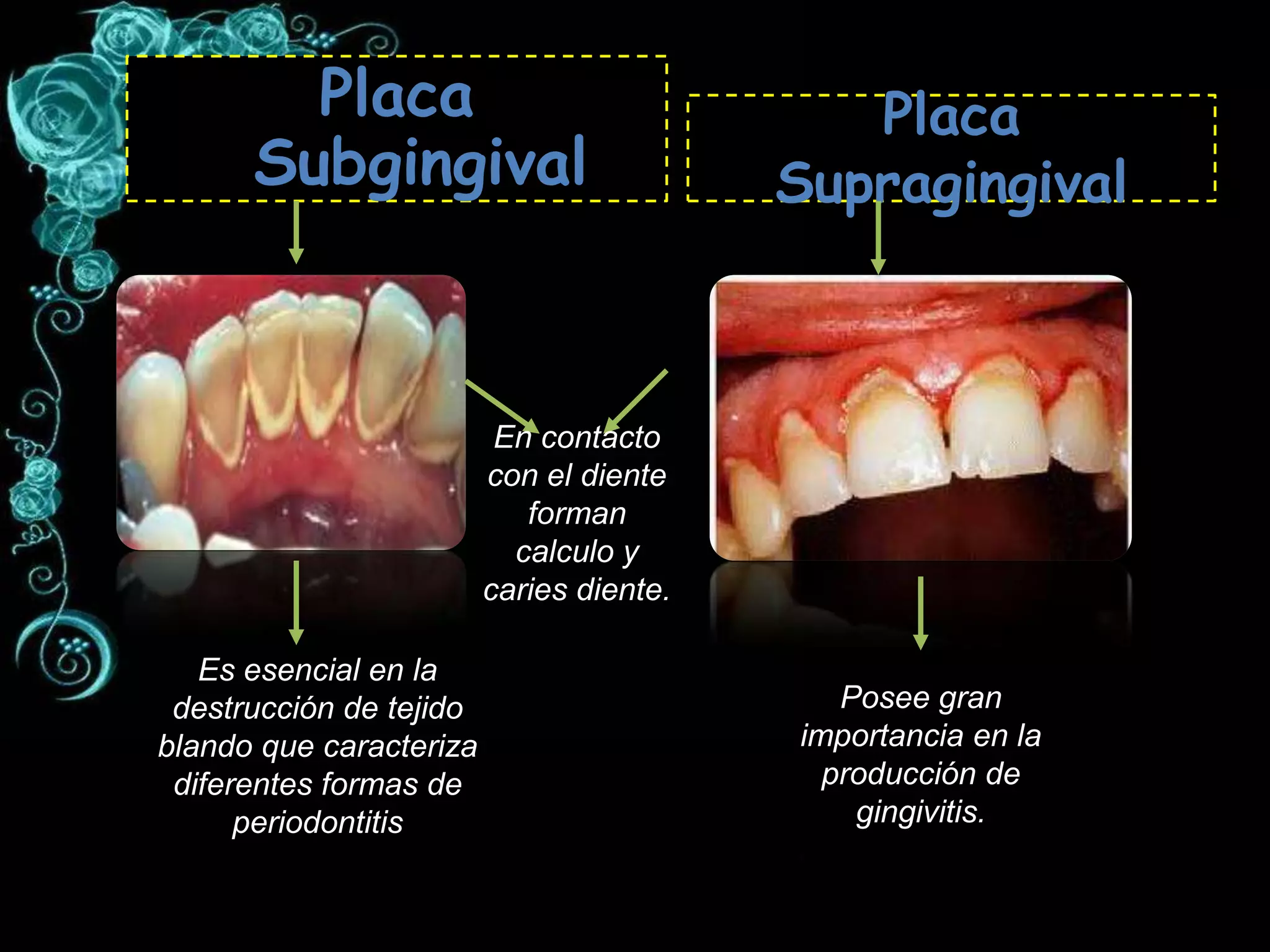 Microbiologia de la placa y caries dental | PPTX
