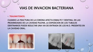MICROBIOLOGIA ENDODONCICA 2022.pptx