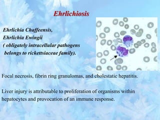 Microbiological aspect of liver | PPTX